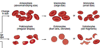 AMIGOS PARA SIEMPRE: MORFOLOGÍA ANORMAL DE LOS ERITROCITOS