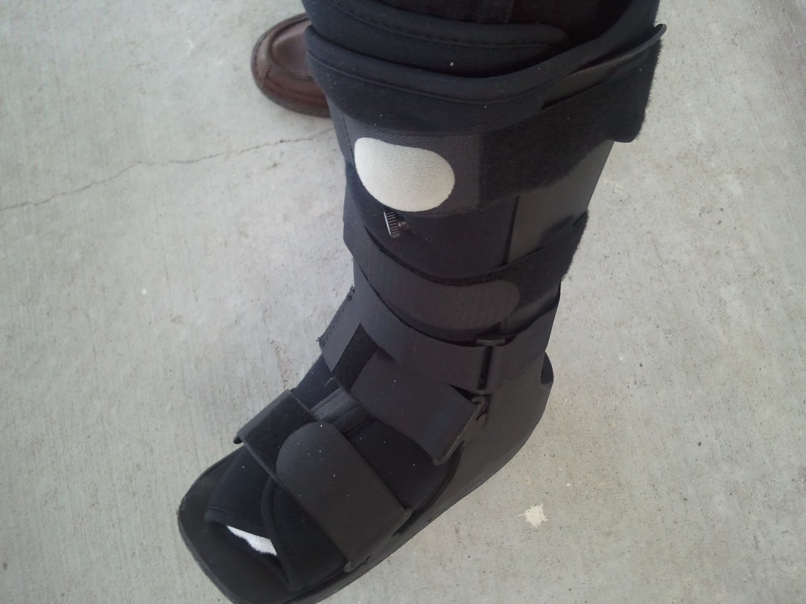 My Achilles tendon rupture experience