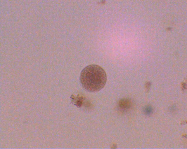 Entamoeba Coli Morphology Entamoeba Histolytica Wikipedia