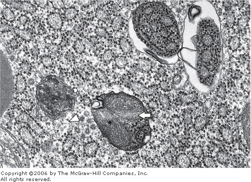 Lysosome Micrograph