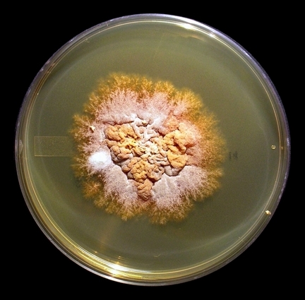 Fun With Microbiology (What's Buggin' You?): Epidermophyton floccosum