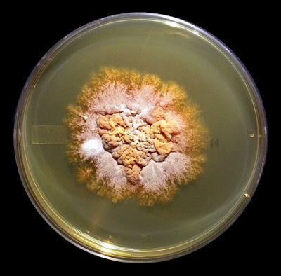 Fun With Microbiology (What's Buggin' You?): Epidermophyton floccosum