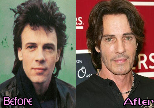 Rick Springfield Plastic Surgery Blog: Rick Springfield Plastic Surgery ...