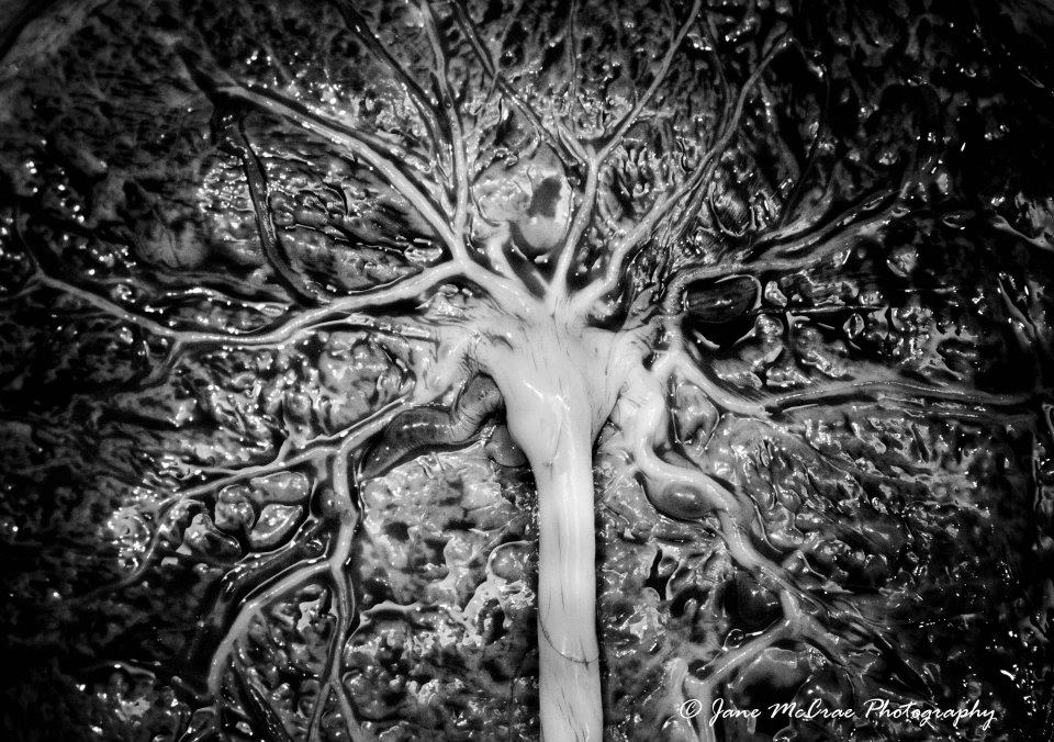 Janine Melo: O que fazer com a PLACENTA?