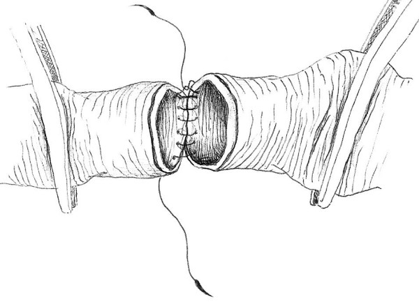 Small Animal Talk: Small animal surgery: history of the anastomosis