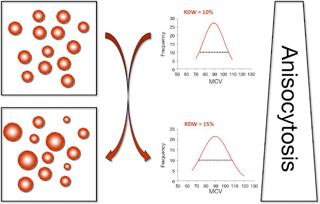 Ý nghĩa của chỉ số RDW (Red Cell Distribution Width) trong lâm sàng ...
