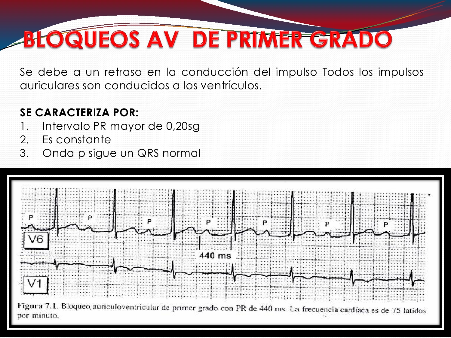 TEMAS MÉDICOS: ELECTROCARDIOGRAMA NORMAL