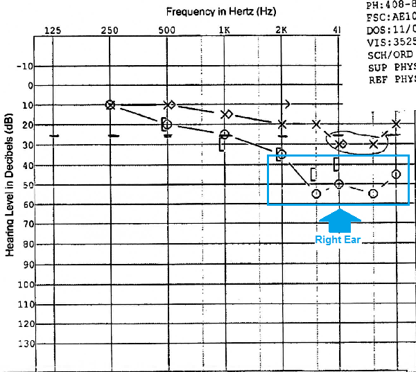 Arnold the Acoustic Neuroma: March 2013