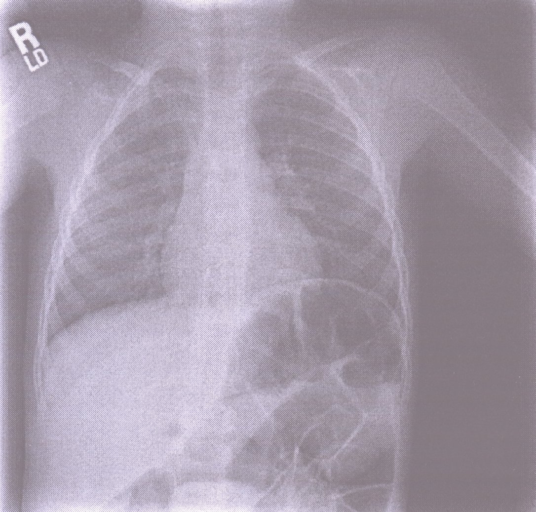 A Maggids Musings: X-rays