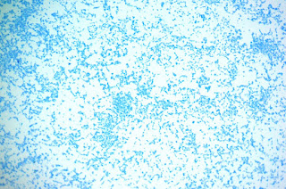 SIMPLE STAINING - Microbiology Lab Notes