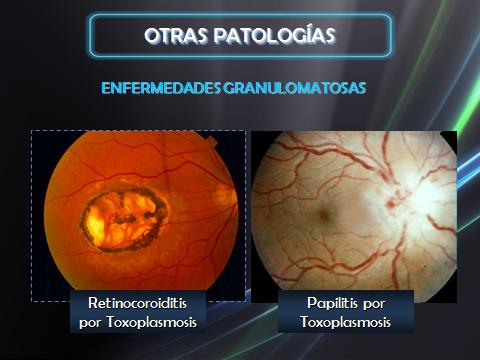 POSTGRADO DE NEUROCIRUGÍA - HOSPITAL CENTRAL DE MARACAY - VENEZUELA ...