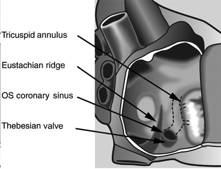 Dr Han Naung @ Henry Han : Electrophysiology and Heart Rhythm ...