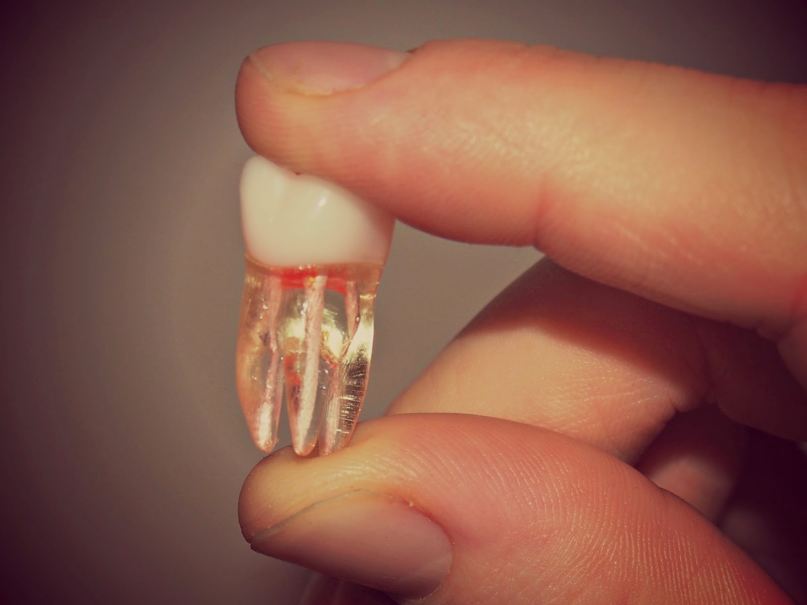 A Guide to Endodontics - TOOTH GERM