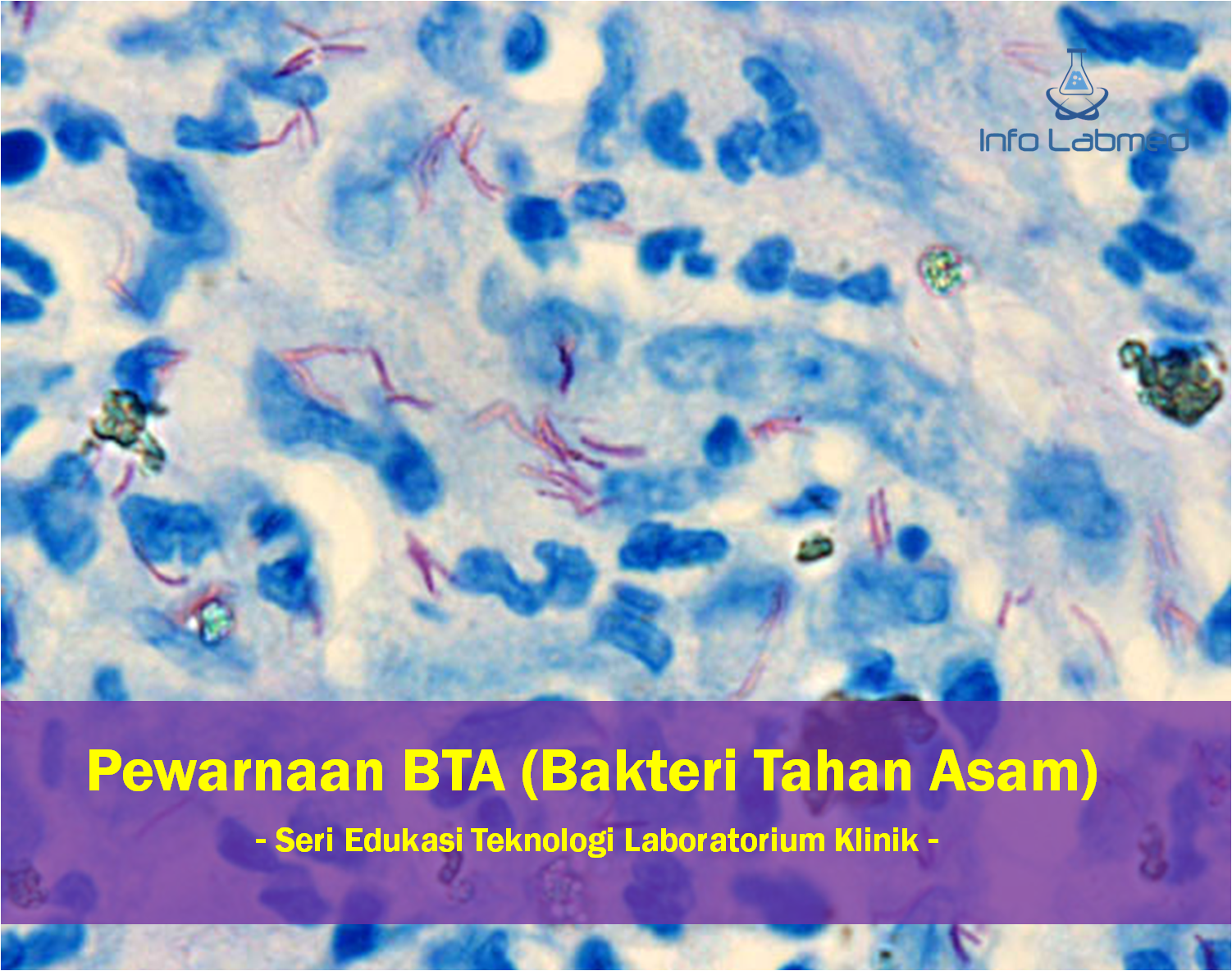 Pewarnaan BTA (Bakteri Tahan Asam) - Seri Edukasi Teknologi ...