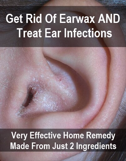 Home Remedy For Earwax And Ear Infections Part 1 Health And Diy Ideas