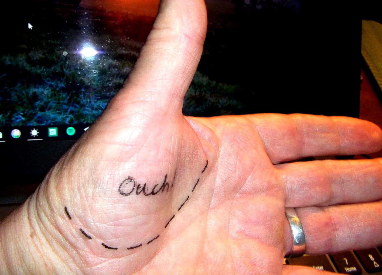 Magnon's Meanderings: Ouch!