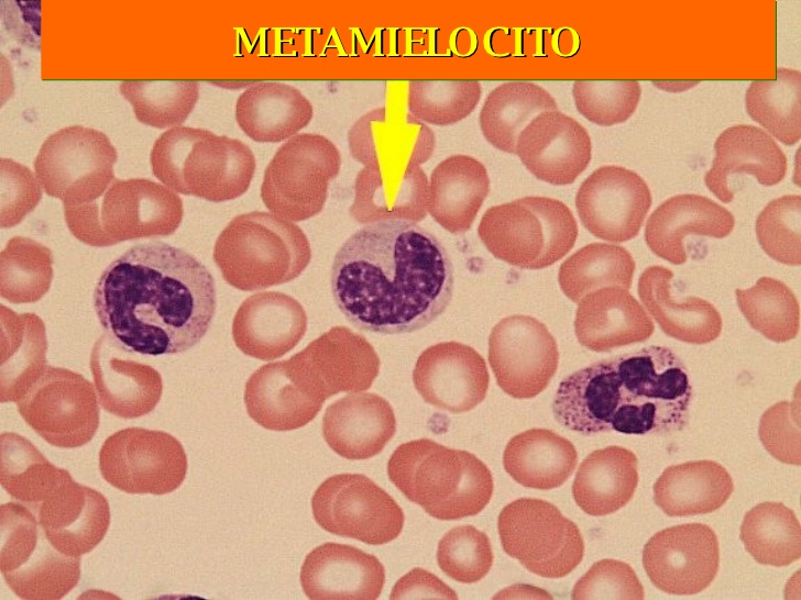 Hematologia Fichero USAC: 4. Metamielocito