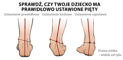 Biomasaż: Kinezyterapia w schorzeniach układu ruchu.