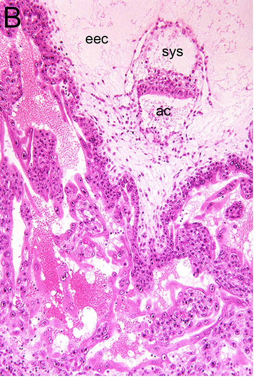 The Evolving Placenta: Carnegie Collection of human embryos