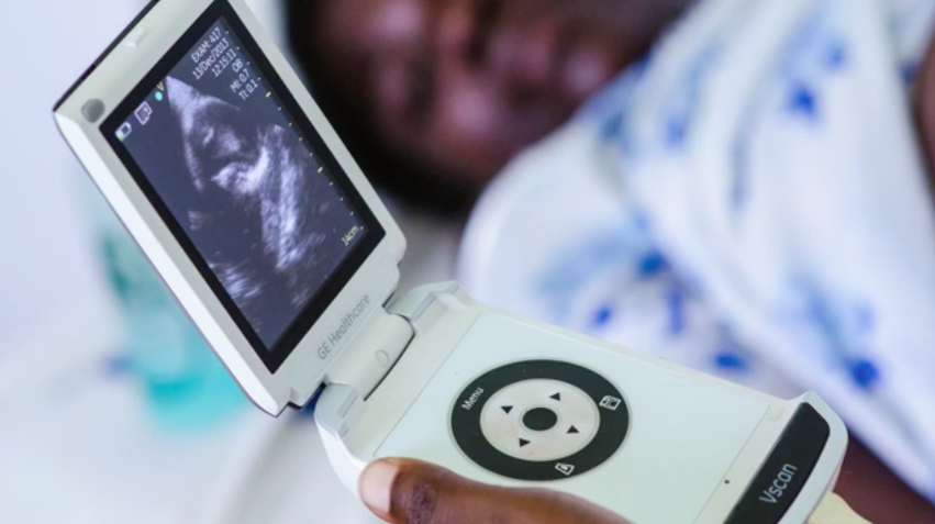 Portable Ultrasound Device V scan Will help reduce Pregnancy related ...