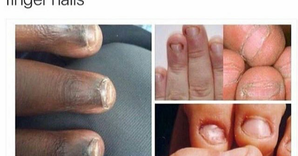 Dose Of Debauchery: Morning Meme: Meat Beaters