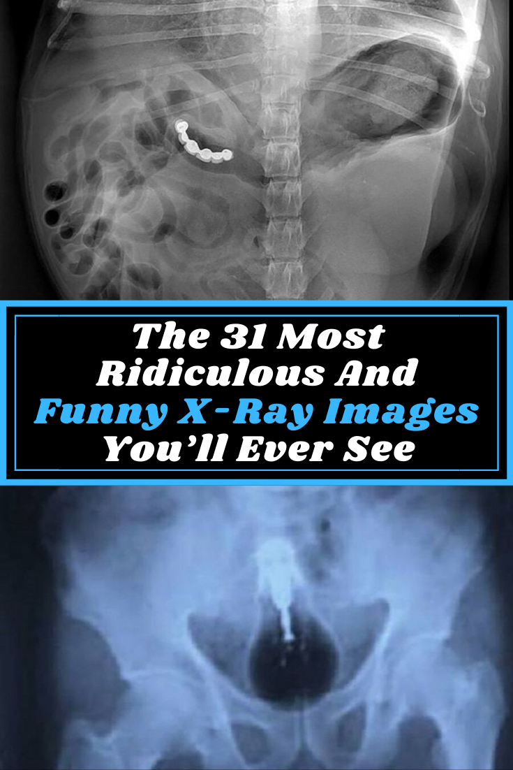 The 31 Most Ridiculous And Funny X-Ray Images You’ll Ever See