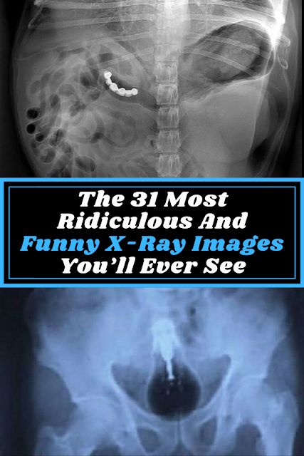 The 31 Most Ridiculous And Funny X-Ray Images You’ll Ever See