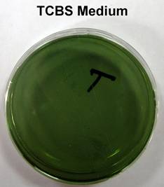 My Simple blog: MACAM-MACAM MEDIA PADA BAKTERIOLOGI