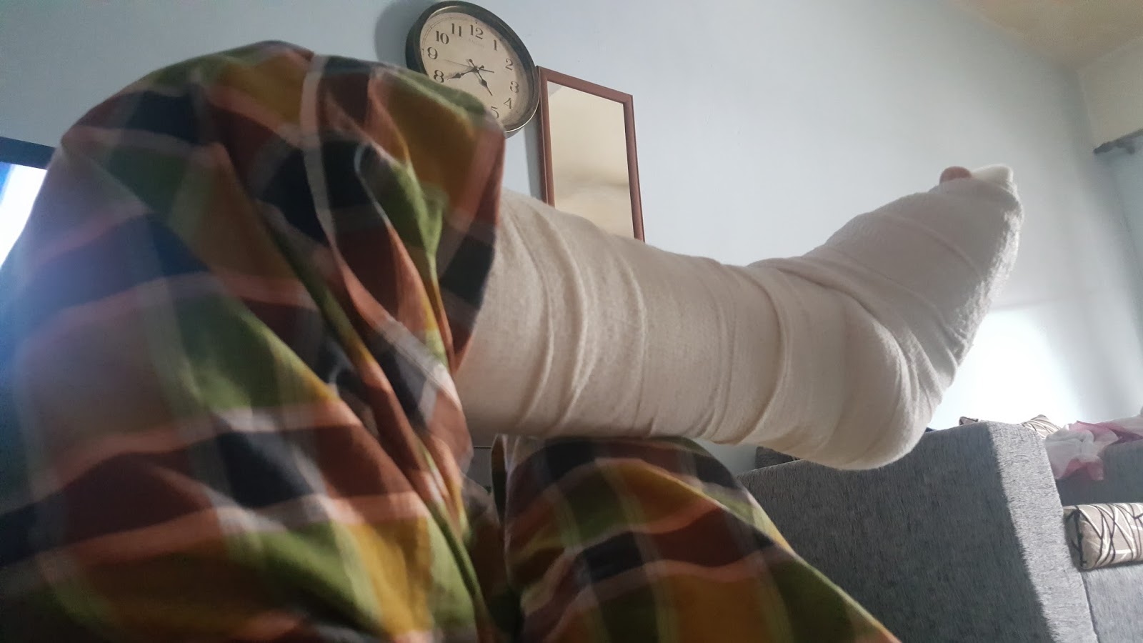 Tanakampung: Putus Urat Keting (Achilles Tendon Rupture)