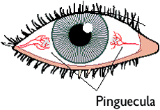 The external eye |Drug Alcoholic Trauma Allergy Treatment