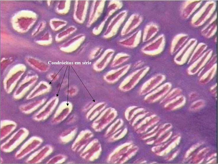Tecidos do Corpo Humano e suas Patologias: TECIDO CARTILAGINOSO