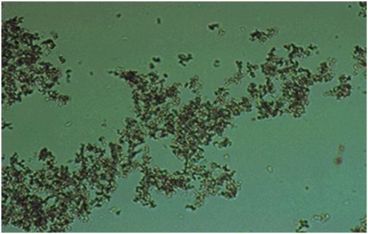 AMORF ÜRAT KRİSTALİ - Microbiology Laboratory Turkey