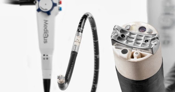 New Incisionless Device to Correct Reflux by Medigus | Fauquier ENT Blog