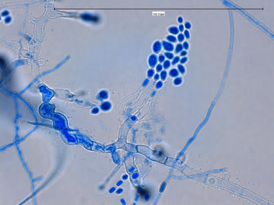 Fun With Microbiology (What's Buggin' You?): Arthrographis species