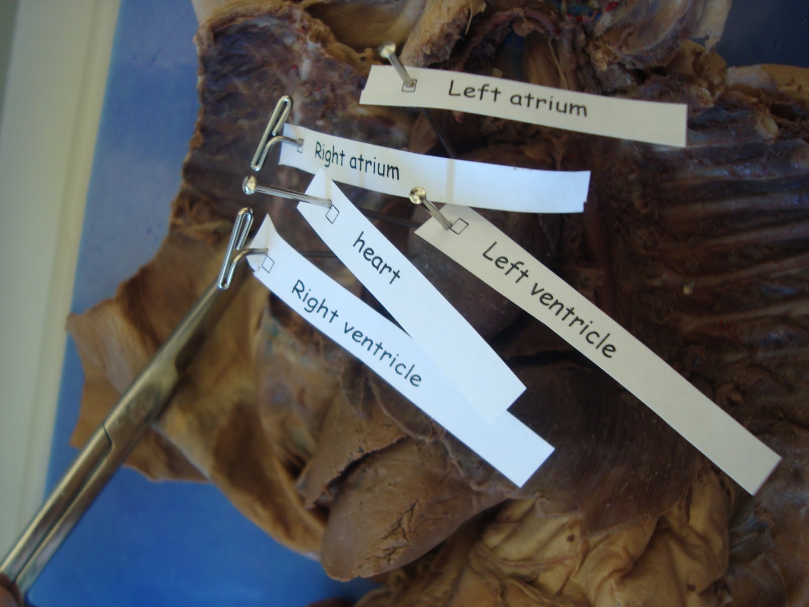 Cat Dissection: Human Anatomy: Cardiovascular System