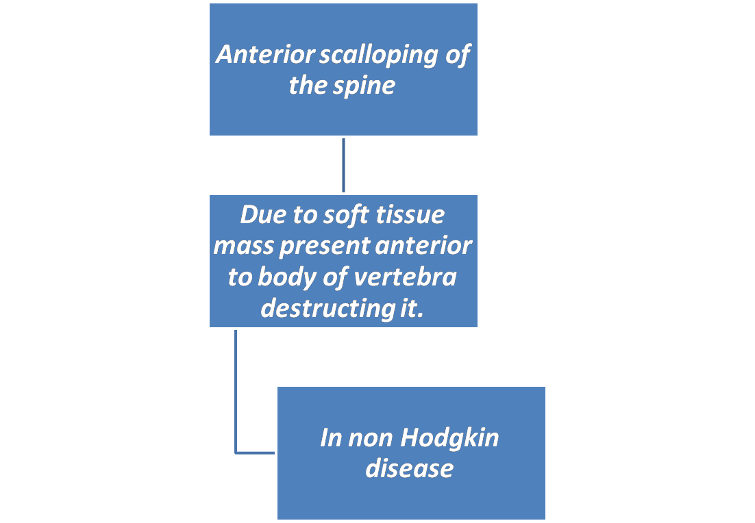 Radiology Pearls: Anterior scalloping of vertebral body