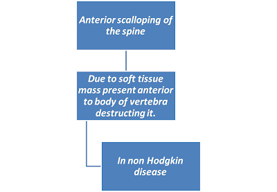 Radiology Pearls: Anterior scalloping of vertebral body
