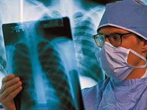 RADIOLOGIA X: RAYOS X