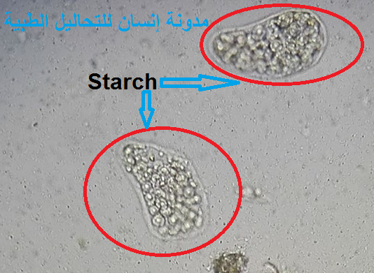 أطلس عينات البراز تحت المجهر Stool analysis