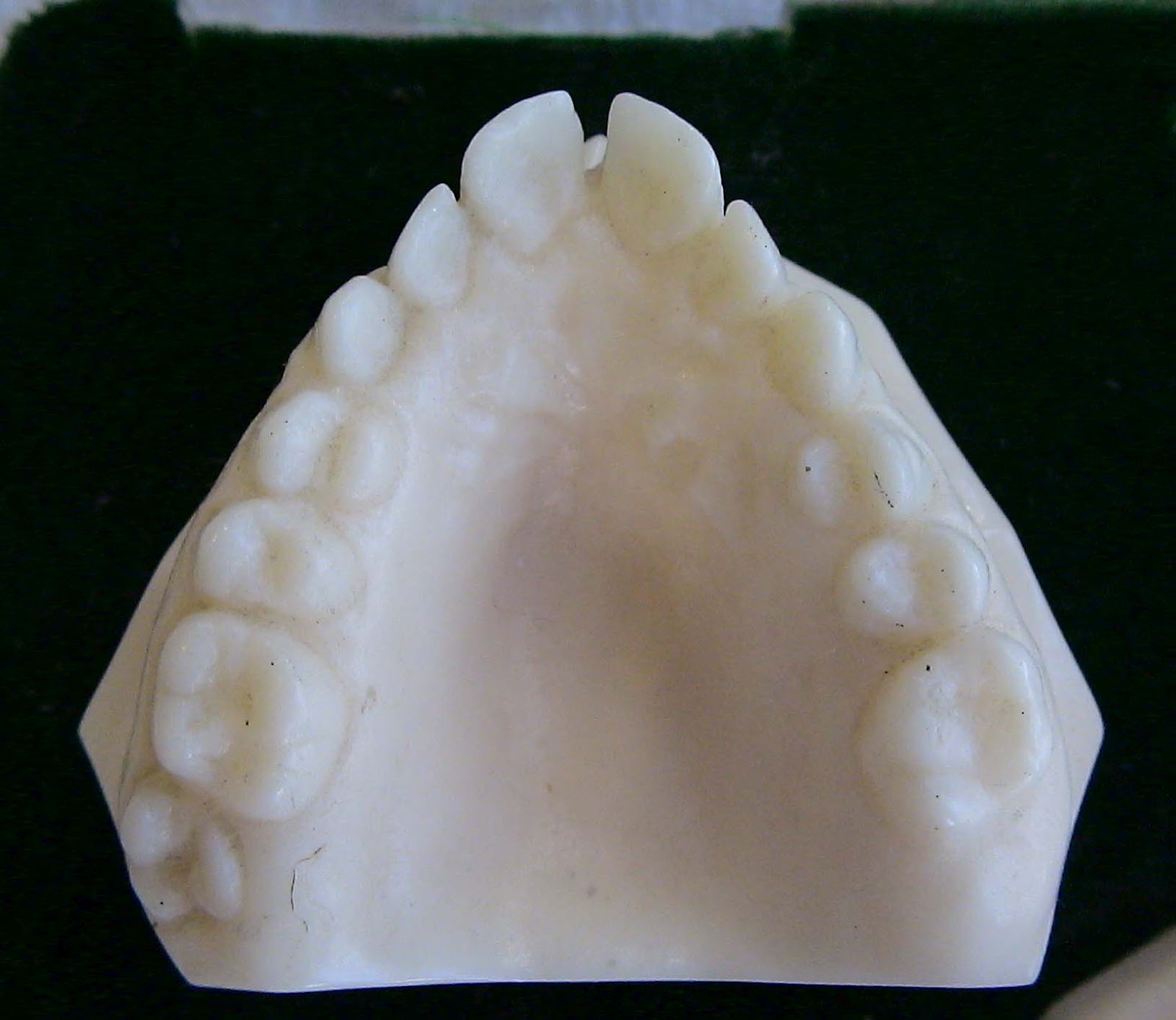 Una Boca para toda la Vida: Deglución atípica. Deglución infantil.