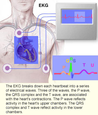 Medical Instrumentation: ElektroKardioGraph (EKG)