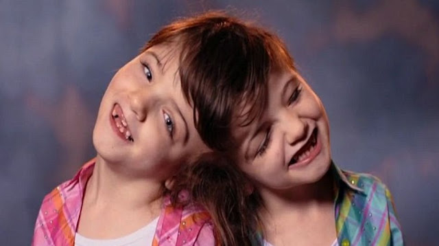 Les jumeaux siamois: 2017