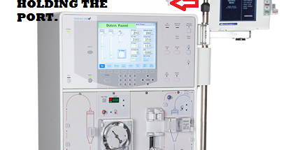 How is my Fresenius K, K2 dialysis machine set-up?