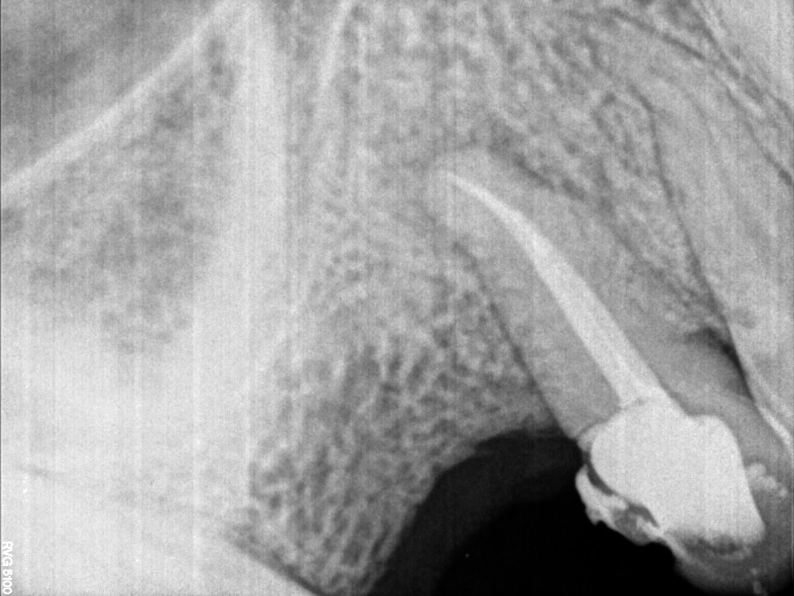 Endodontics: June 2011