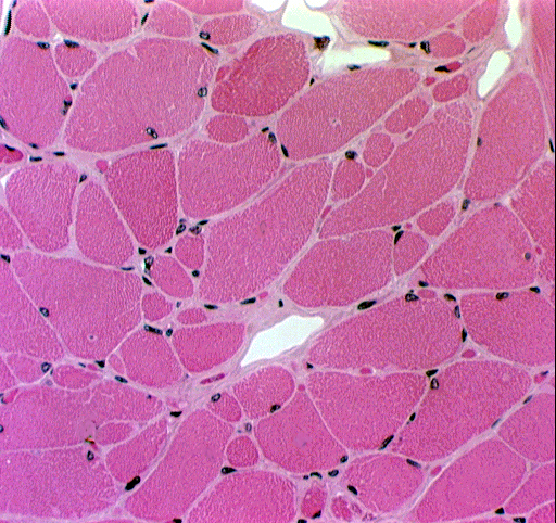 Histología en Imágenes : TEJIDO MUSCULAR ESQUELETICO