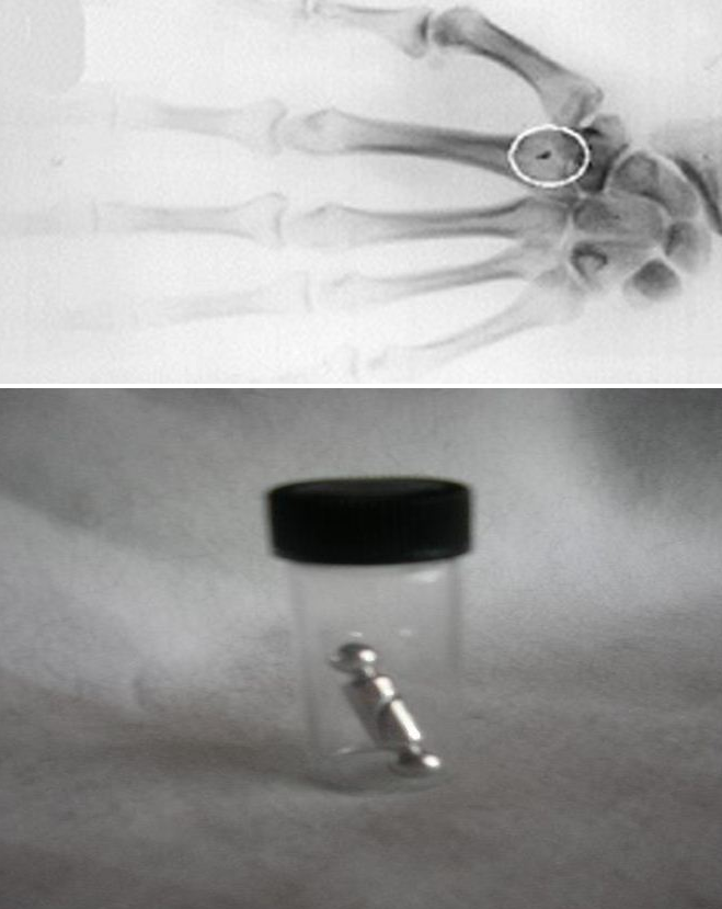 I TEMPI SONO MATURI: We Are Not Alone - The Alien Implants