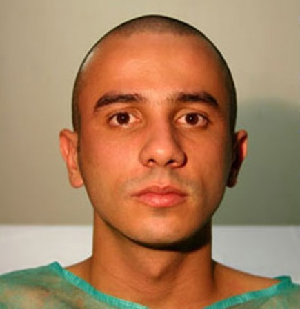 Man with a dog face, or the first 'Dogman'