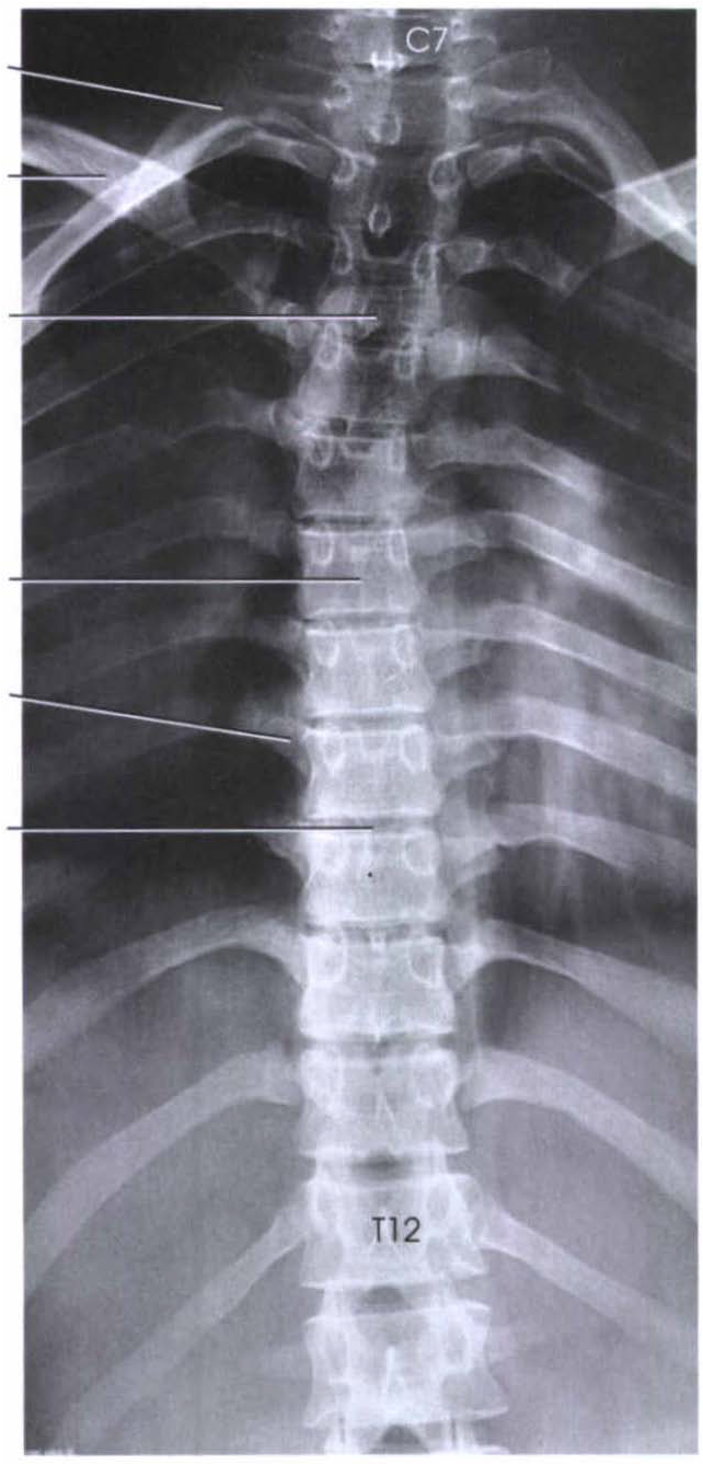 TUKANG RONTGEN BLOG'S: teknik radiografi thorakal