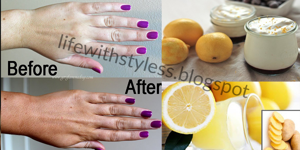 Best remedy to Remove Sun Tan From Hands Over Night | Life With Styles