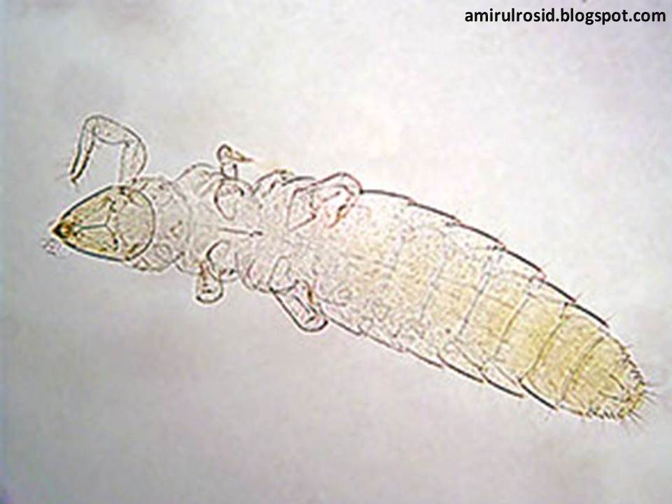 Amirul Rosid Al-Farizi: MAKALAH INSECTA AMETABOLA